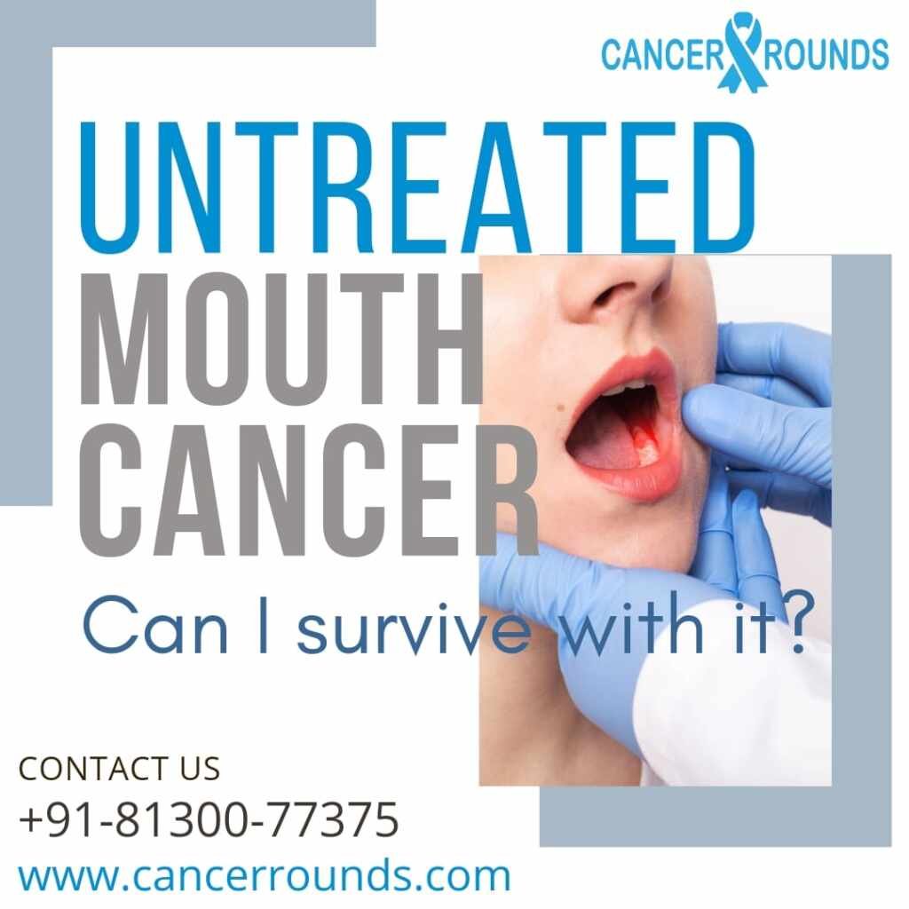 Mouth Cancer Archives - Cancer Rounds